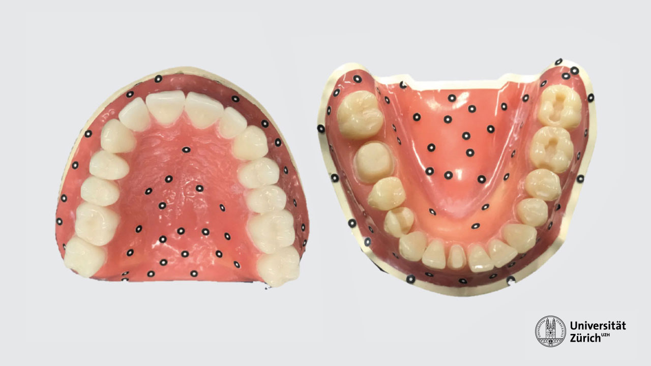 CEREC – DS Discover
